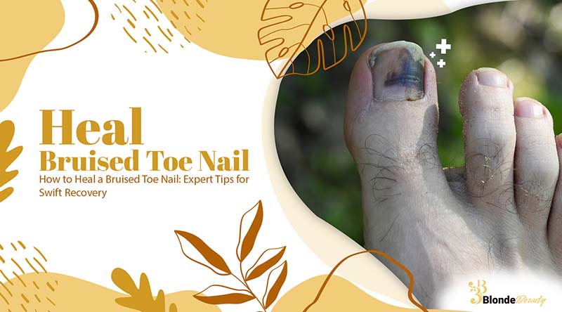 How to Heal a Bruised Toe Nail: Expert Tips for Swift Recovery