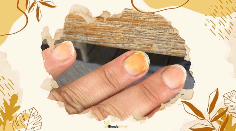 Why is My Nail Orange? Exploring Causes of Nail Discoloration - Blonde ...